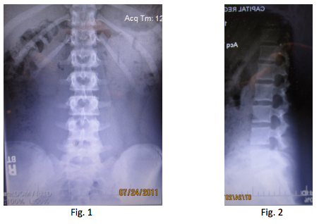 Dr. Tim Maggs: The Importance of X‐Rays in the Standing Position
