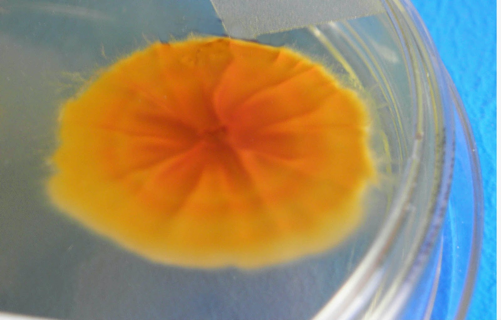 ATLAS MICOLOGIA: TRICHOPHYTON TONSURANS (2)