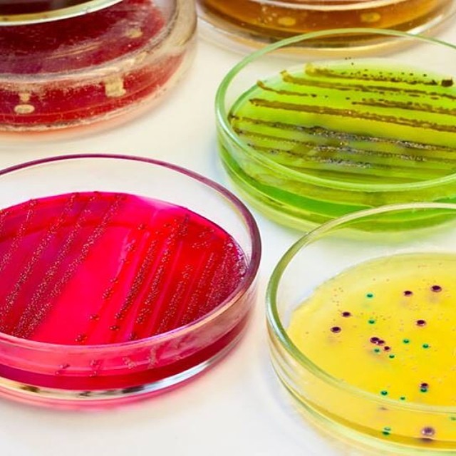 Macam-macam media untuk perbenihan mikroorganisme ~ REGA ANALIS