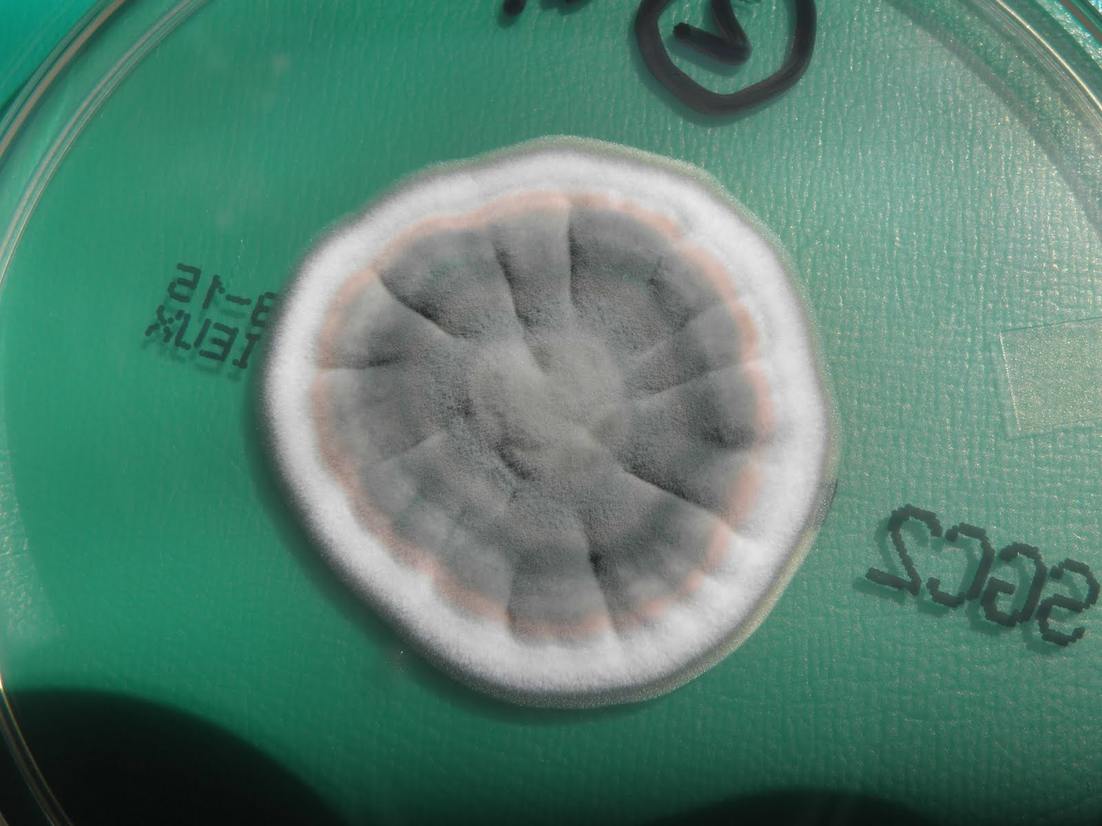 ATLAS MICOLOGIA: ASPERGILLUS VERSICOLOR