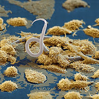 SALUD Y MEDICINA: Uso de la Auranofina para tratar la Amebiasis