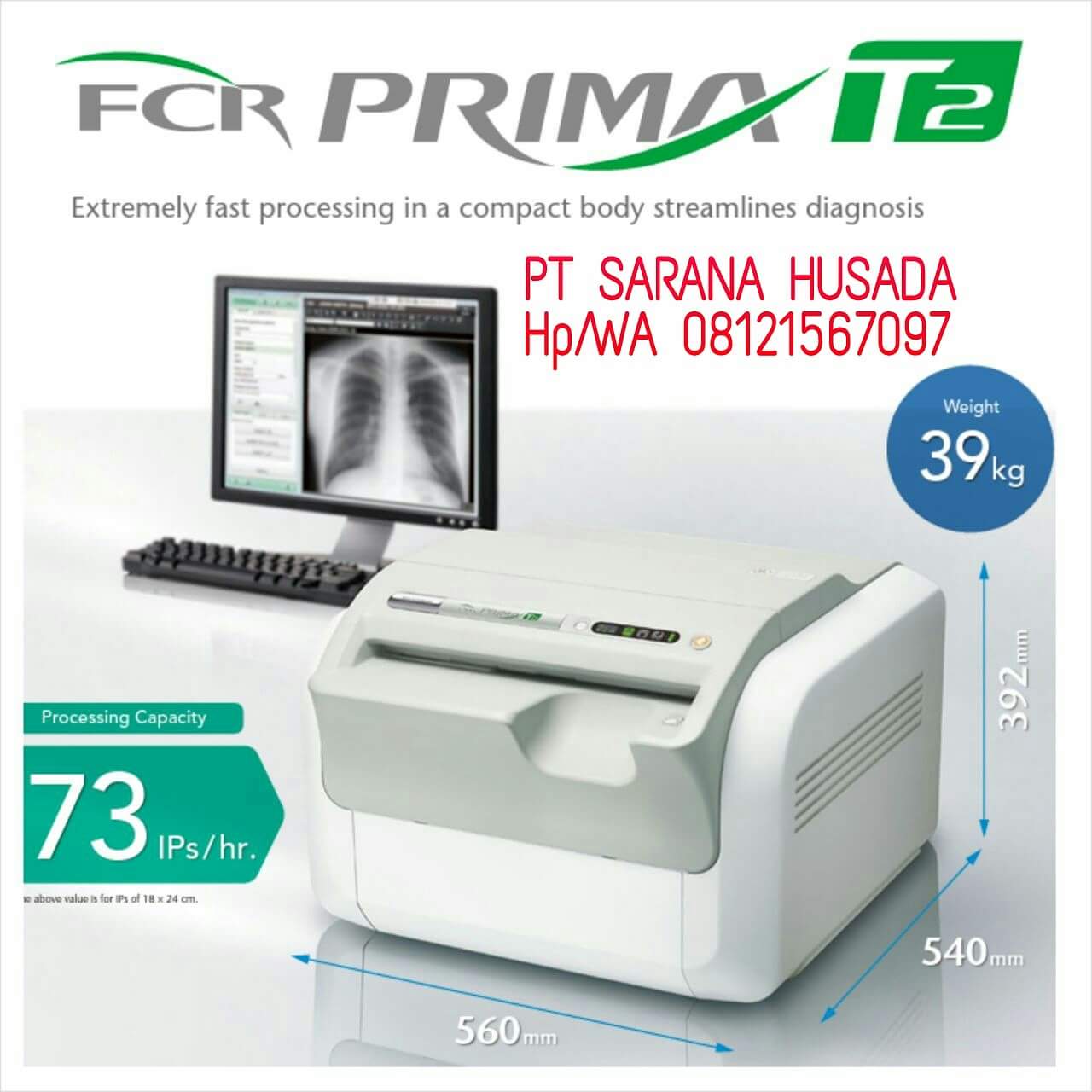 RADIOLOGY DIGITAL, Alat X RAY DILENGKAPI CR FUJI PRIMA T2 - ALAT X-RAY ...