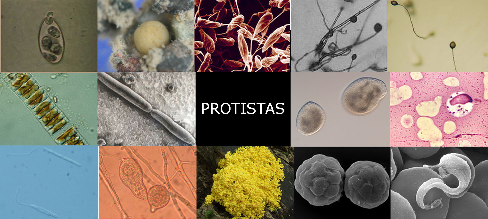 Hemoterapia2017: Reino protista