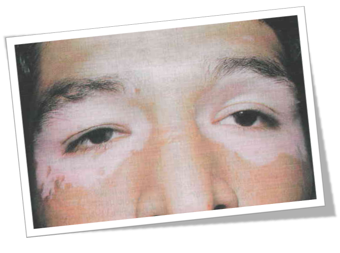 CoSiTaS dE mEdIcInA!!: DiScRoMiAs!!