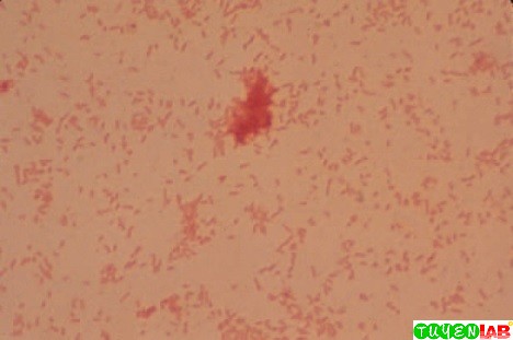 [Microbiology] Atlas of Haemophilus and Other Fastidious Gram-Negative ...