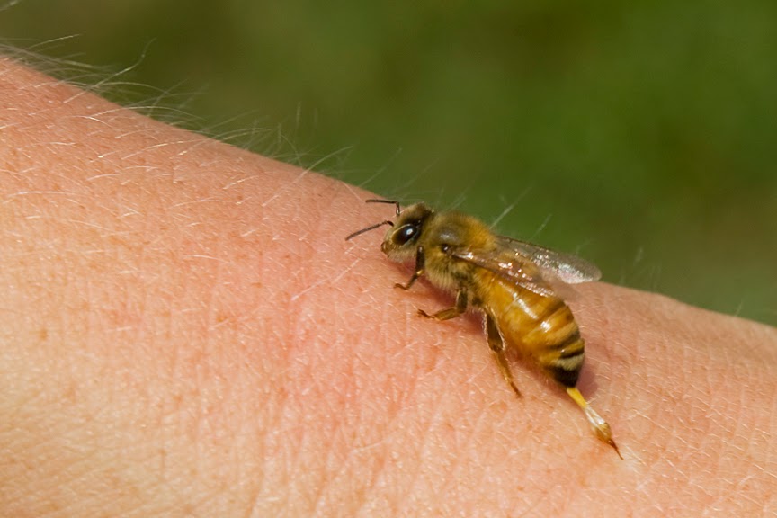 Home Remedies For Honey bee sting ~ Health And Beauty Tips