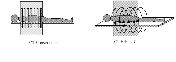 Modulo Intensivo De Técnica Radiológica 1 Guanacaste: Tomografía ...