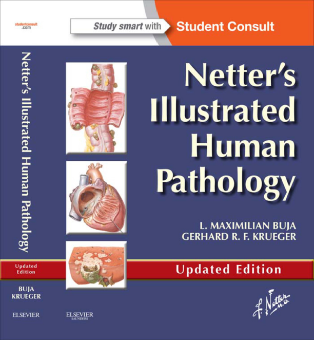 Netter's Illustrated Human Pathology Updated 1st Edition ~ Essentials ...