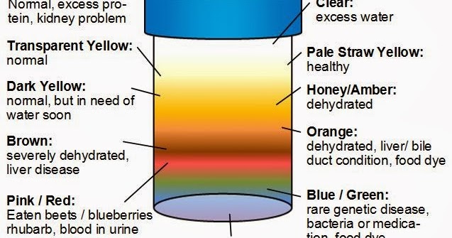 What Color Is Healthy Urine | Garage Article