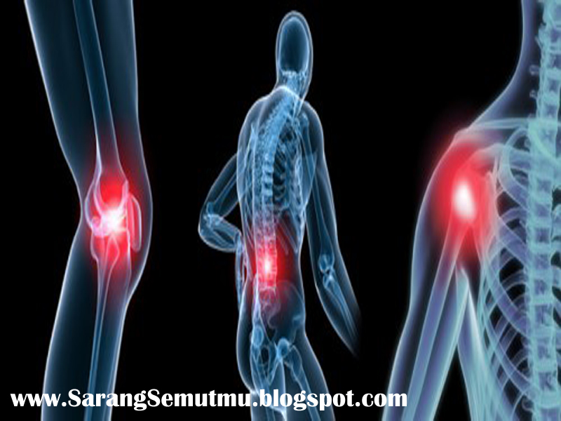 Rematik tulang - SarangSemutmu