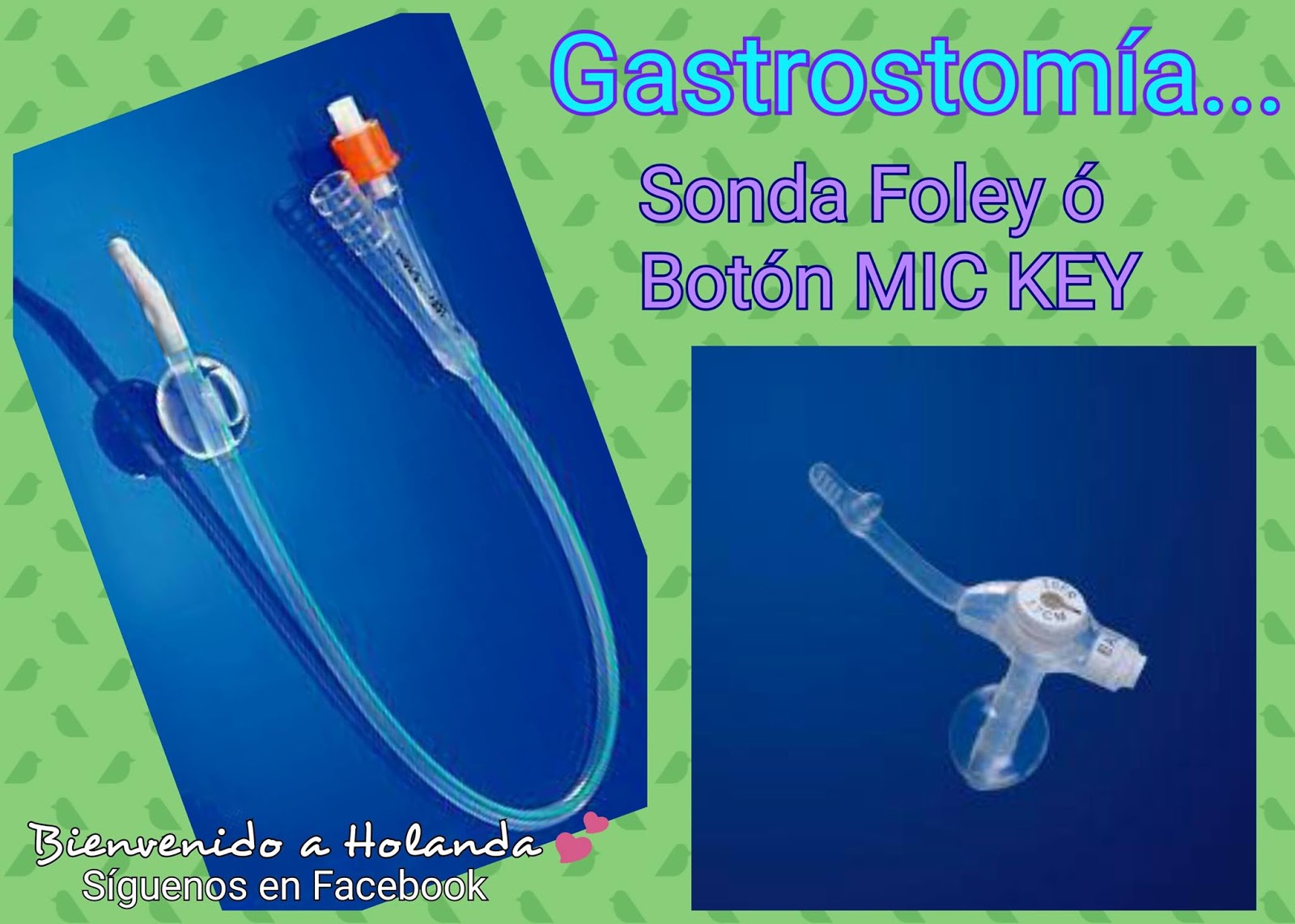 Gastrostomia Que Es