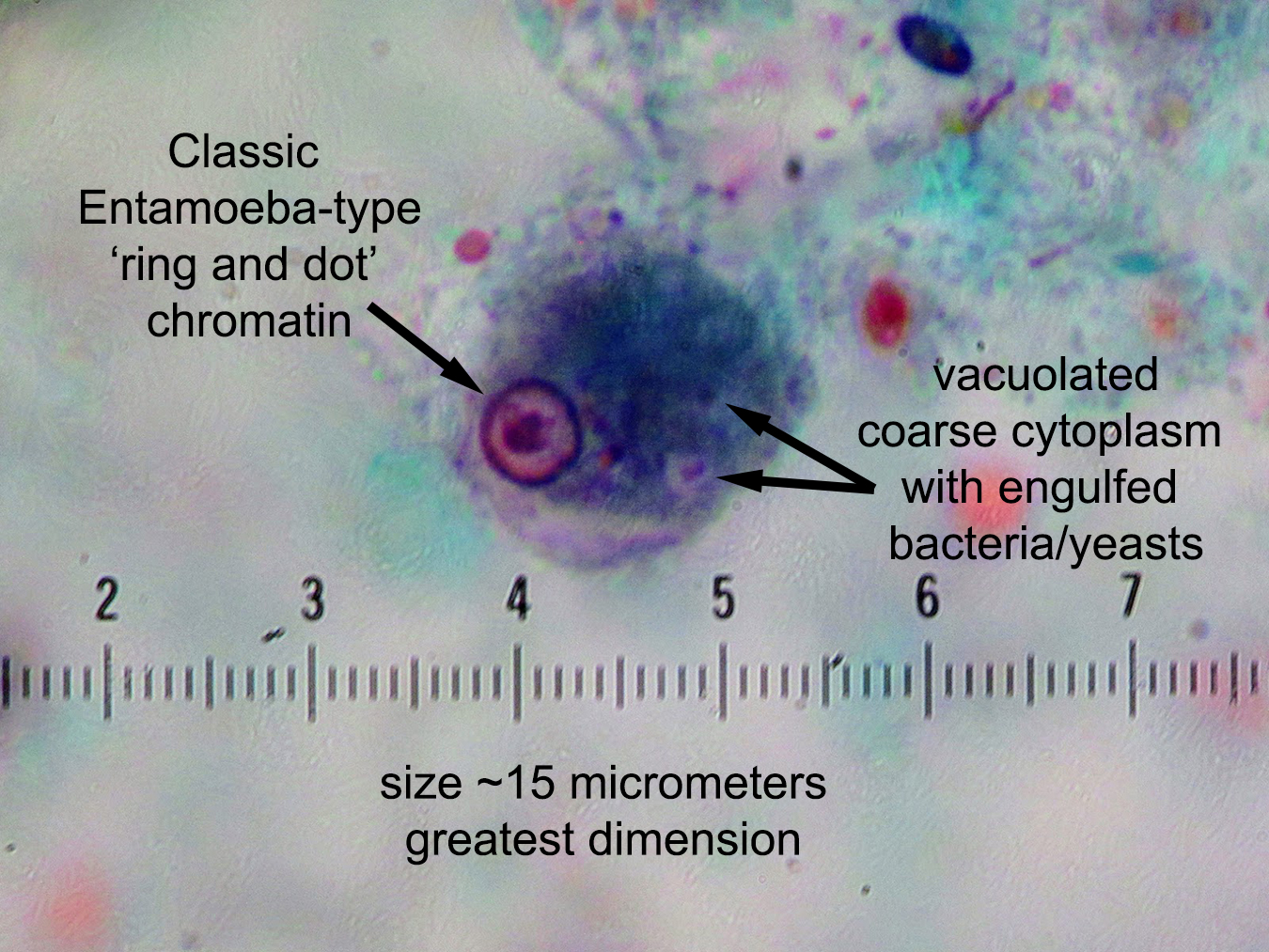 Creepy Dreadful Wonderful Parasites: Answer to Case 478
