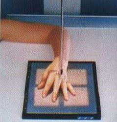 Pemeriksaan Radiografi Ossa Manus 2 ~ Bocah Radiography