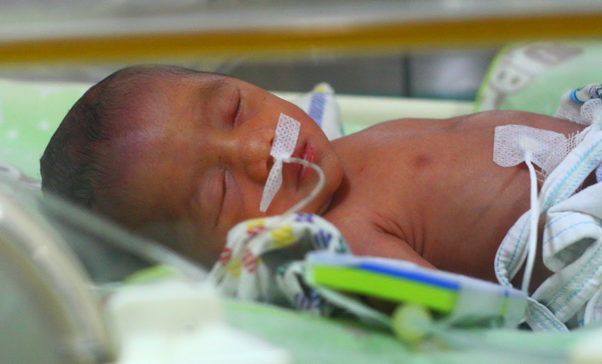 Bayi Berat Lahir Rendah (BBLR) ~ SMART NURSE