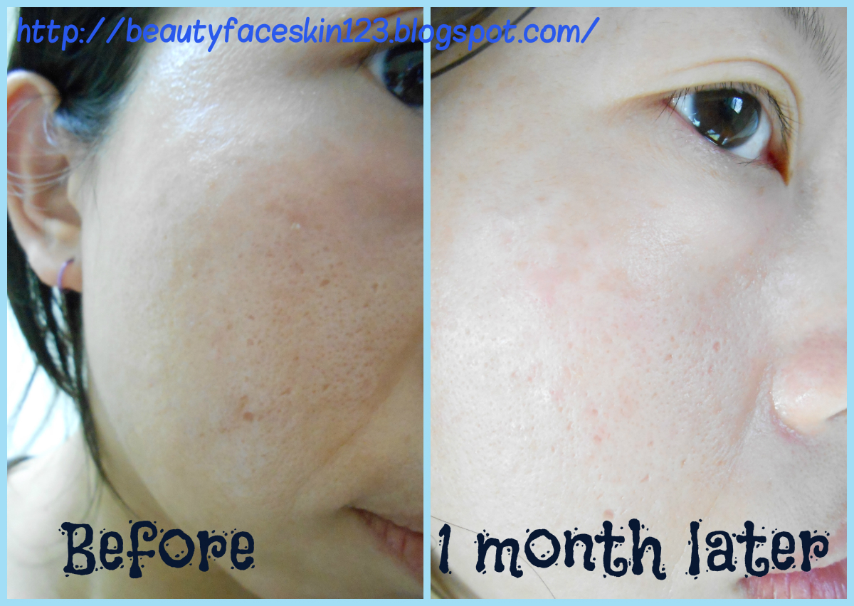 GREAT SKINandLIFE: REVIEW ON SKINMISO PORE ZERO NIGHT CREAM