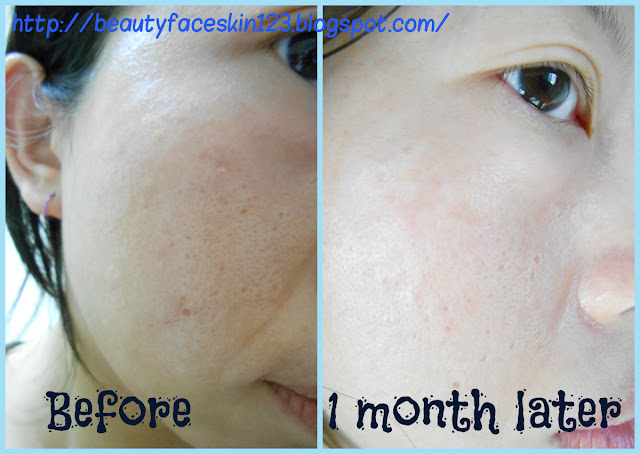 GREAT SKINandLIFE: REVIEW ON SKINMISO PORE ZERO NIGHT CREAM