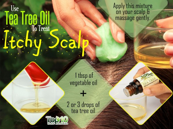Here Are The Top 10 Remedies For Itchy Scalp