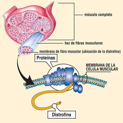 Agrupación Duchenne Chile: ¿Que es La distrofia muscular de Duchenne?