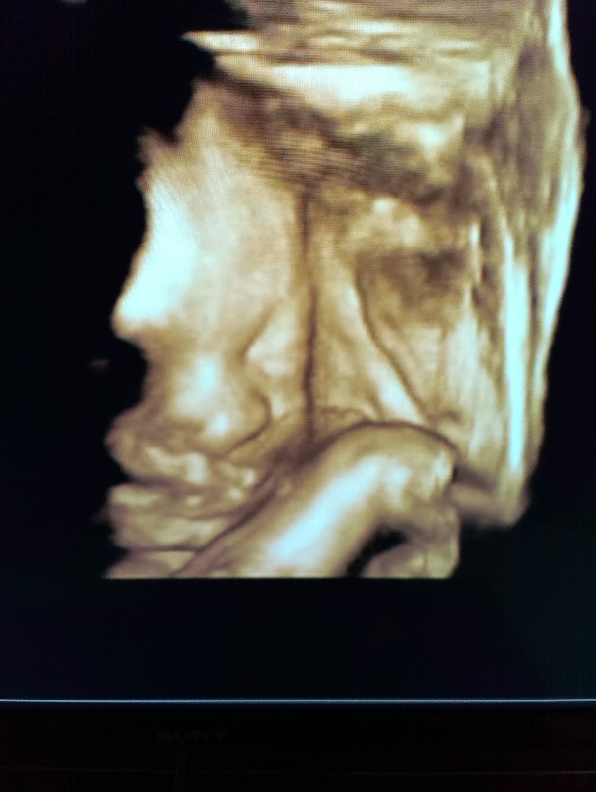 AnnaleighNicolePascal: Pregnancy Series:Our 3D Baby Scan