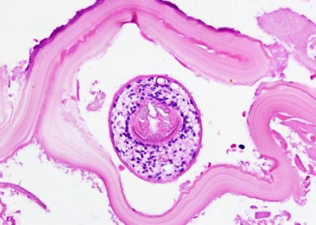 ΝΟΣΗΜΑΤΑ ΠΟΥ ΜΕΤΑΔΙΔΟΝΤΑΙ ΑΠΟ ΤΟ ΣΚΥΛΟ ΣΤΟΝ ΑΝΘΡΩΠΟ