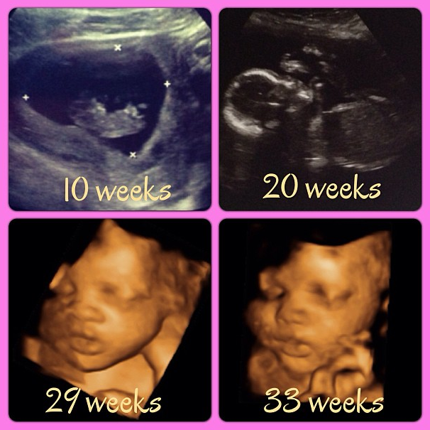 33 weeks - Take 2 4D scan share.