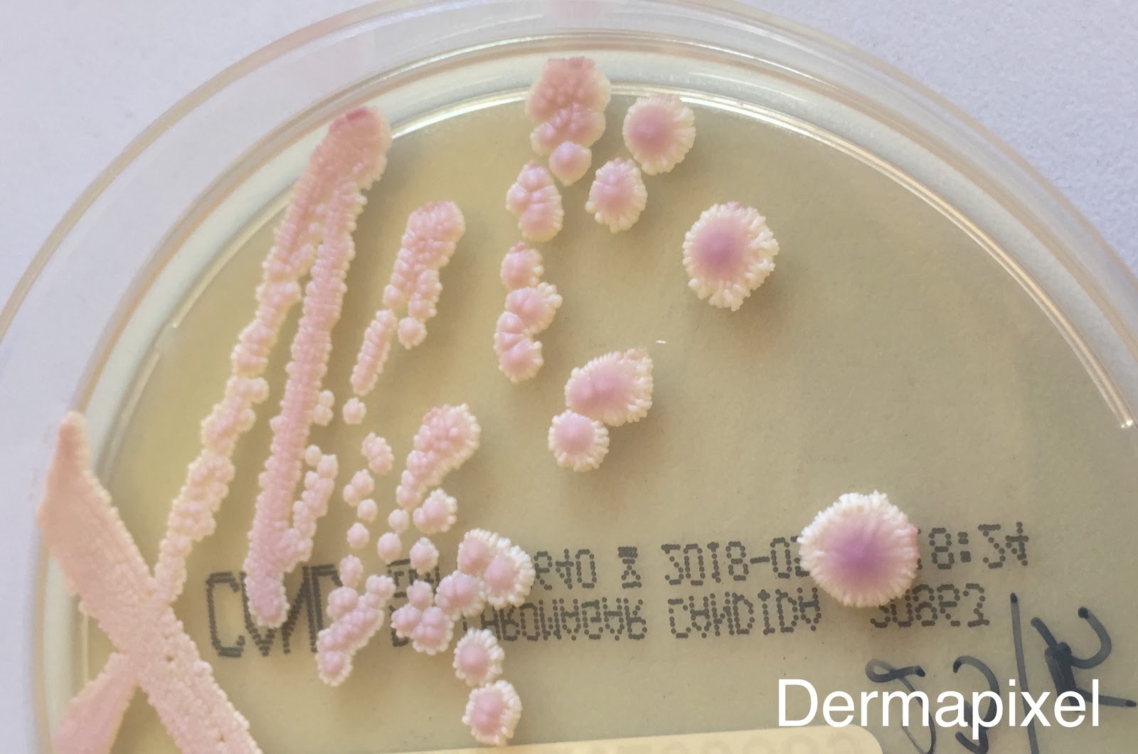 Dermapixel: Erosio interdigitalis blastomicética: lo que viene siendo ...