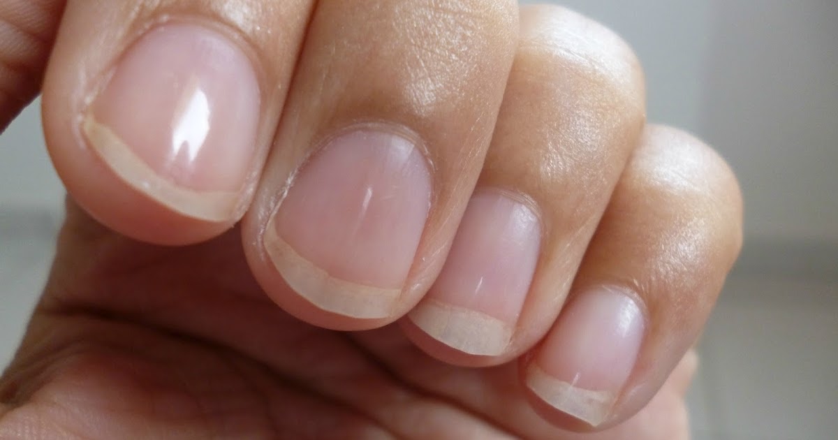 penyebab kuku bergelombang - Perawatan Kuku Sehat