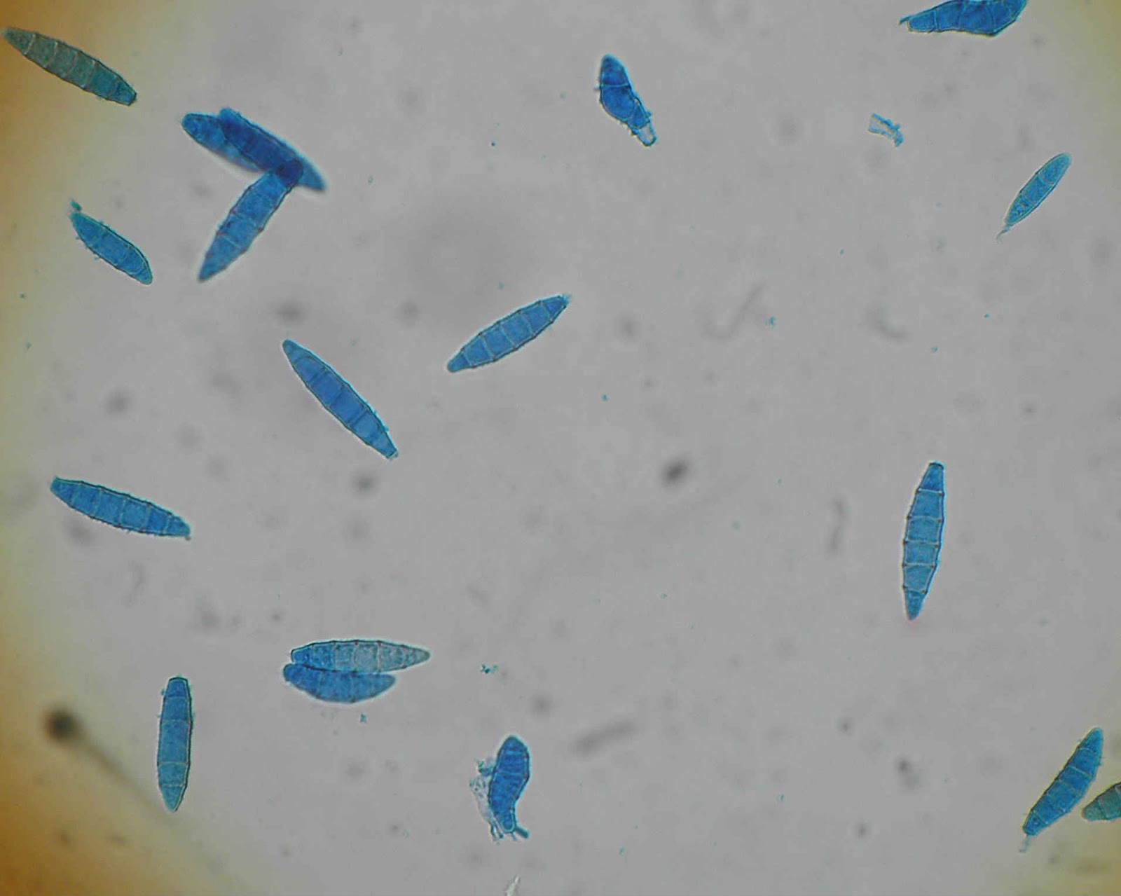 ATLAS MICOLOGIA: MICROSPORUM GYPSEUM