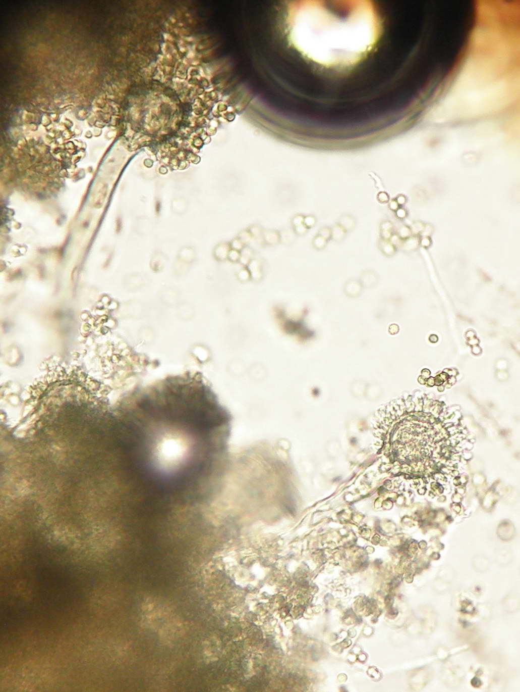 ATLAS MICOLOGIA: ASPERGILLUS GLAUCUS