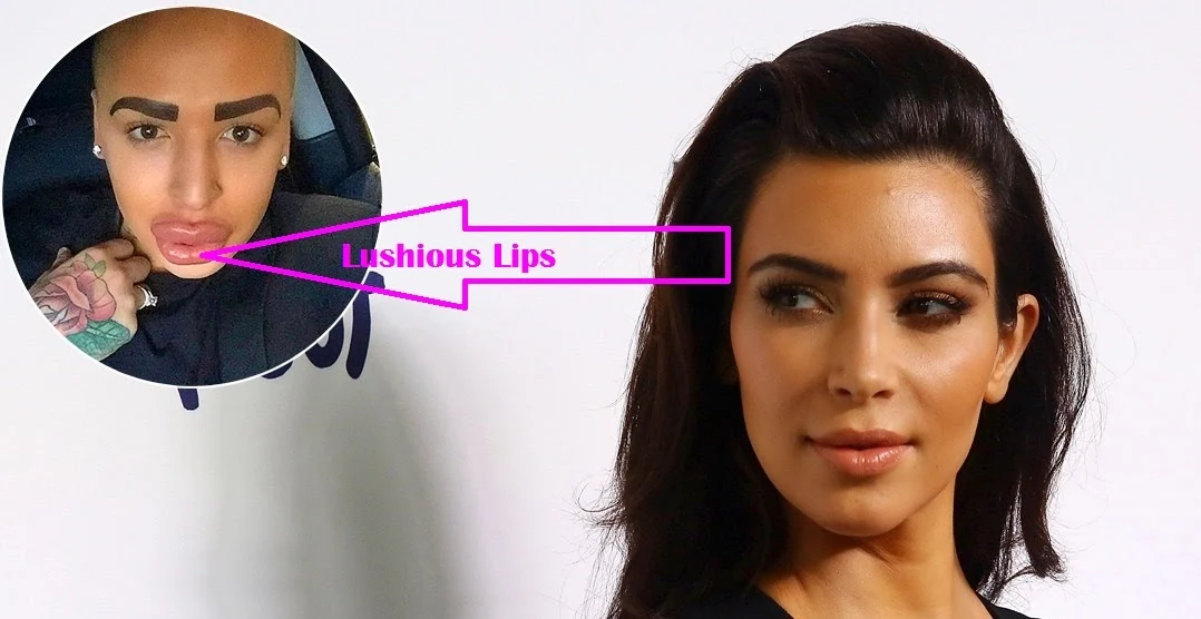 SURGERY GONE BAD! Kim Kardashian's Botched Look Alike - Zinny's Blog