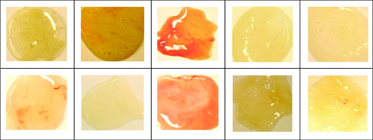 LITTLE BLOG OF PHLEGM