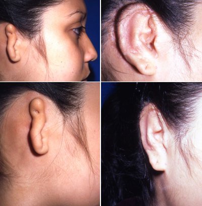 No Sólo Limpiamos Mocos: MICROTIA