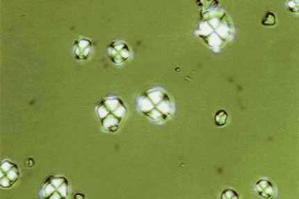 [Haematology] Microscopic Examination of Urinary Sediment - ARTIFACTS ...