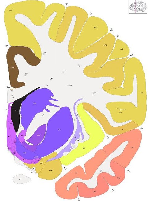 Real Psychiatry: Allen Brain Atlas Is A Serious Upgrade