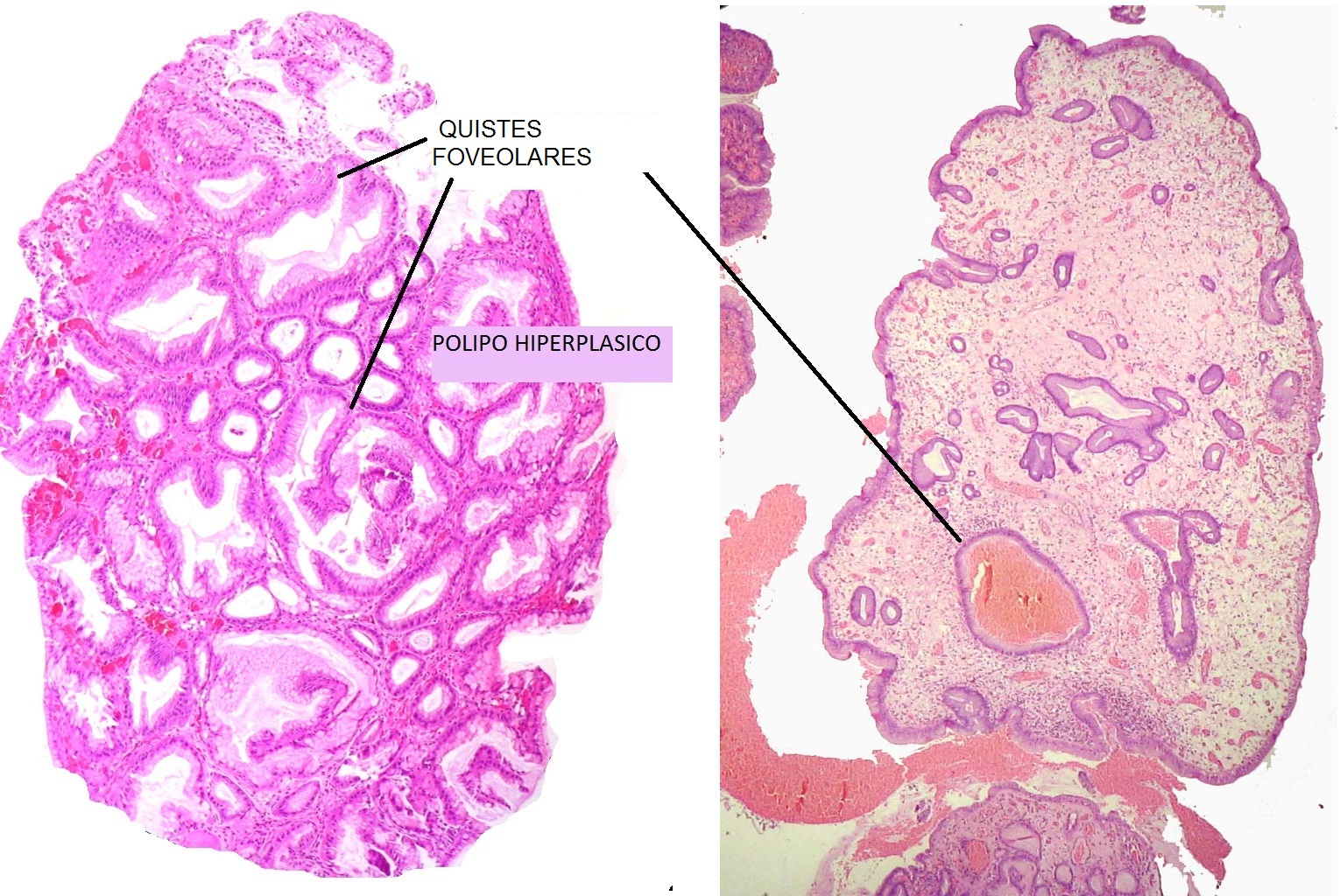 GASTROINTESTINAL AND LIVER HISTOLOGY PATHOLOGY ATLAS: STOMACH ...