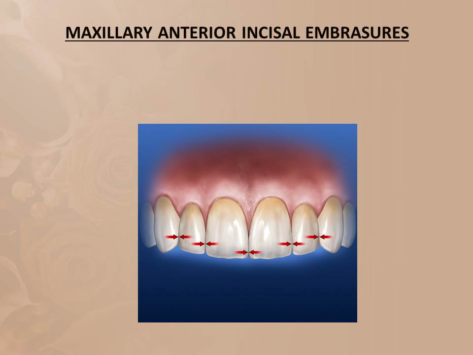 DOs and DONTs in DENTISTRY: 4 Critical Aspects Of Anterior Dental ...