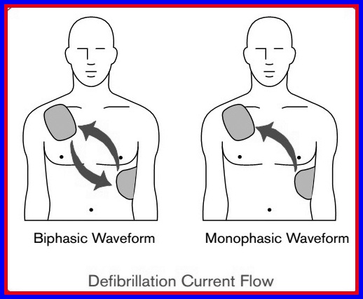 ELECTRONIC EQUIPMENT REPAIR CENTRE : MONOPHASIC AND BIPHASIC DEFIBRILLATION
