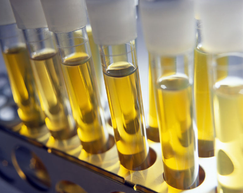 PENGAMBILAN SPECIMEN / SAMPEL URINE | Kampus Kesehatan