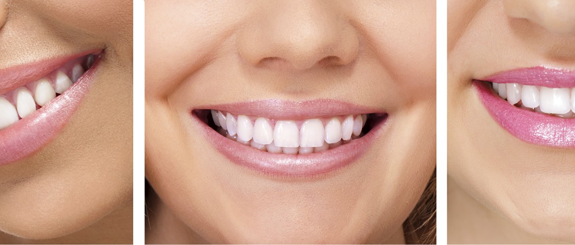 Blog comercial: Zâmbetul marca Dr. Aristide Dan.