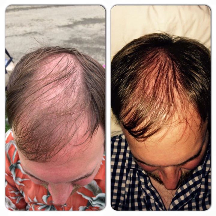 MONAT Global Revolutionary Hair Care Products: Amazing MONAT Before and ...