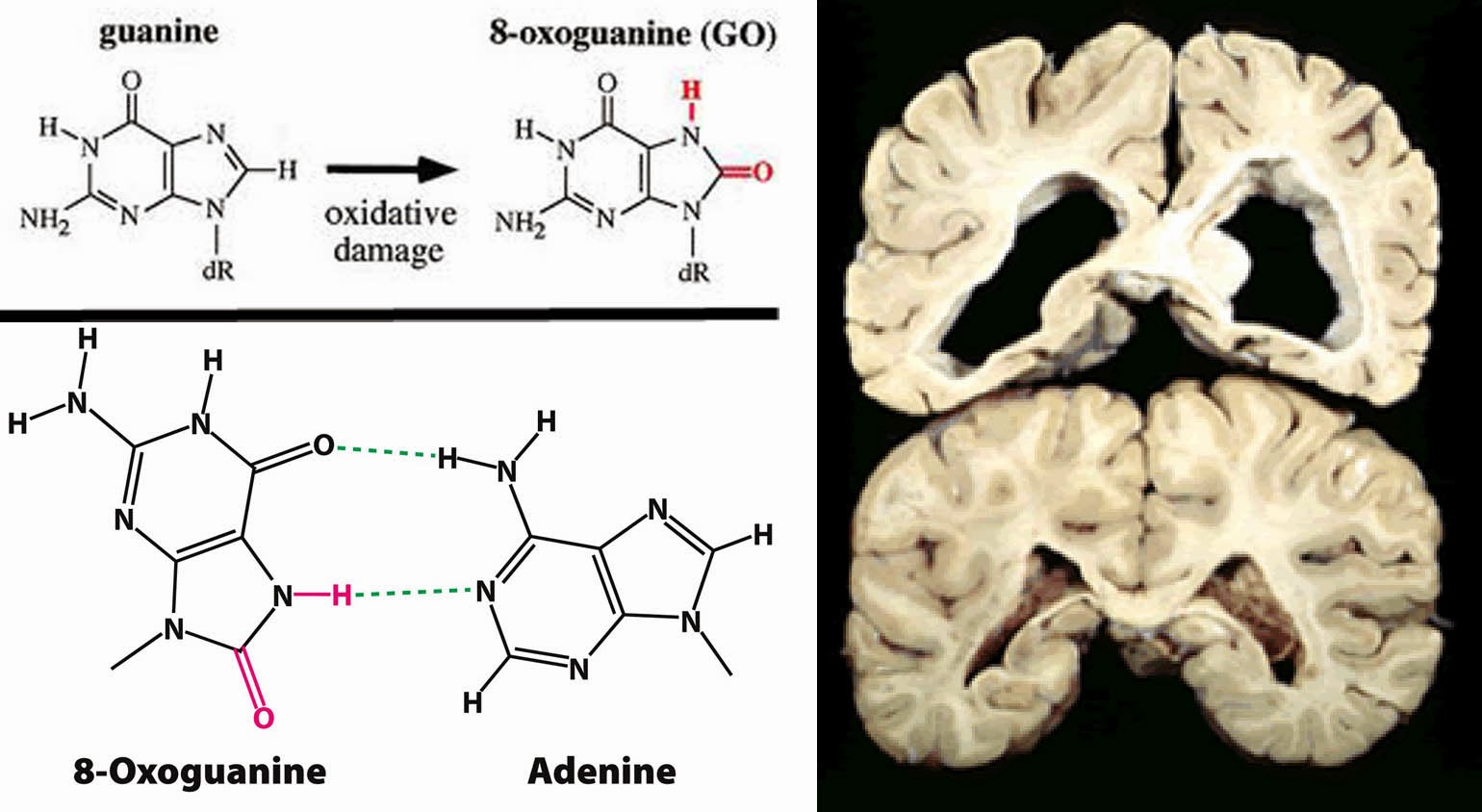 As Many Exceptions As Rules: Covering All Our Bases