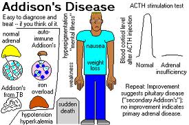 Penyakit Addison (Addison's Disease) - Patofisiologi dan Gejala