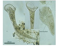 Temas de Seminario: CILIOS