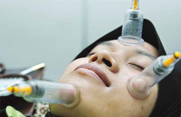 Akupunktur Kecantikan/ dr. Dewi/ 085645030453/ 796B5AD5/ Bratang ...