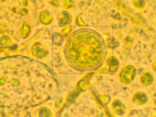 Freshwater & Marine Algae: Specimen #9: Bracteacoccus