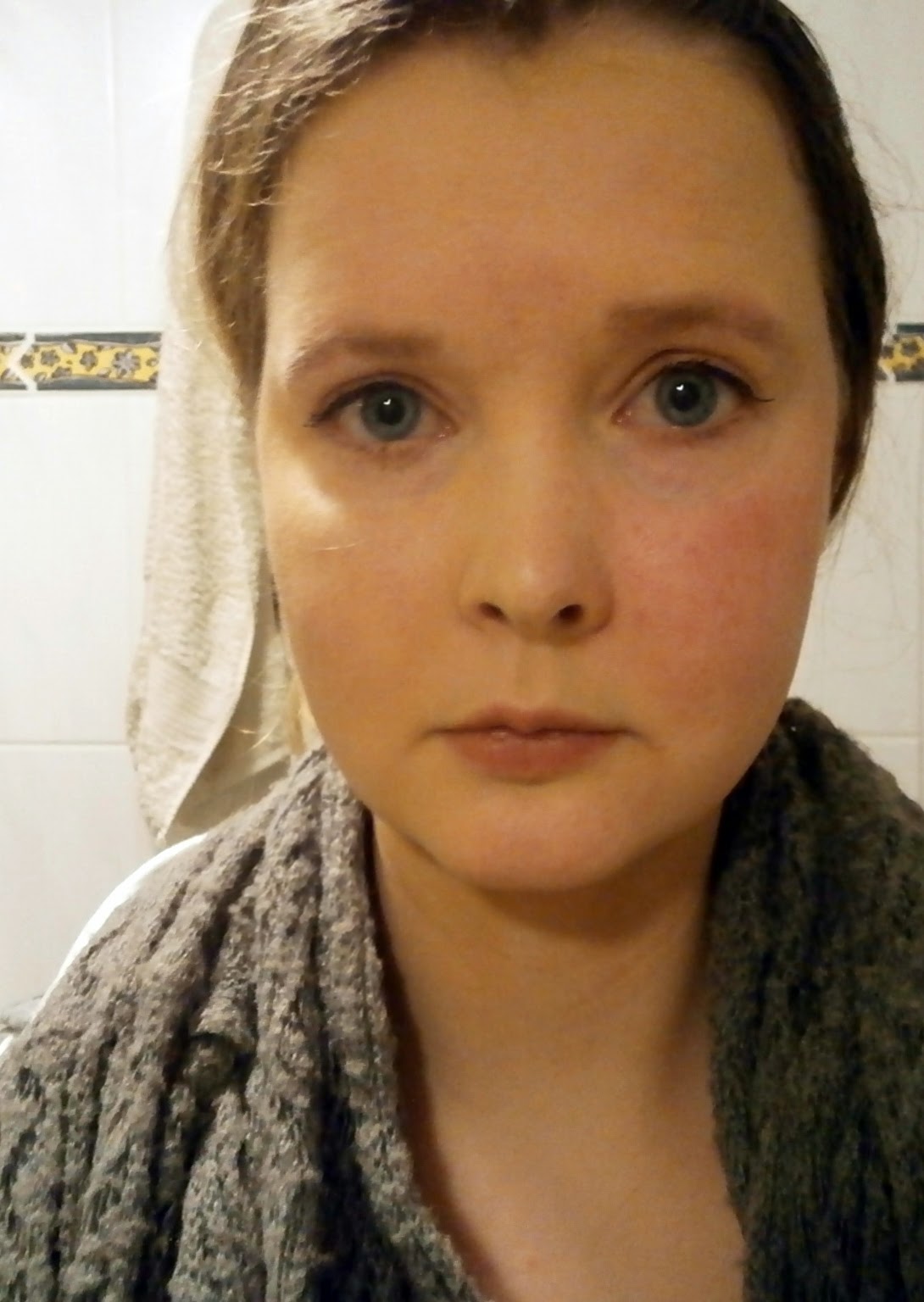 Scarlet Letters, dealing with vascular rosacea, face flushing, burning ...