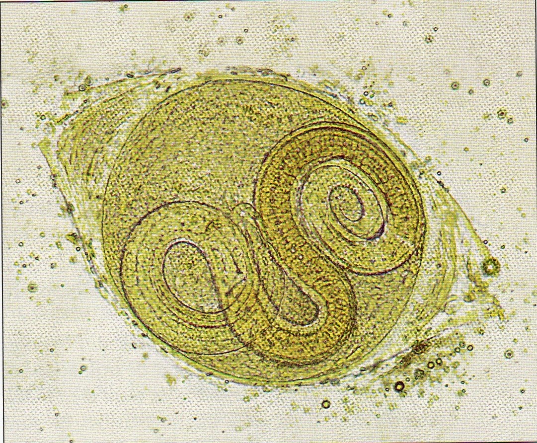 Trichinella Spiralis: Hecho por Karla Courreges Rivero