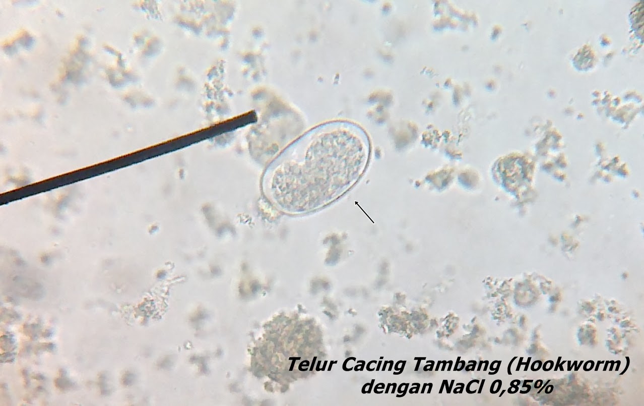 Rizqi Murtafi'ah: Pemeriksaan Telur Cacing Dengan Metode Teknik NaCl Jenuh