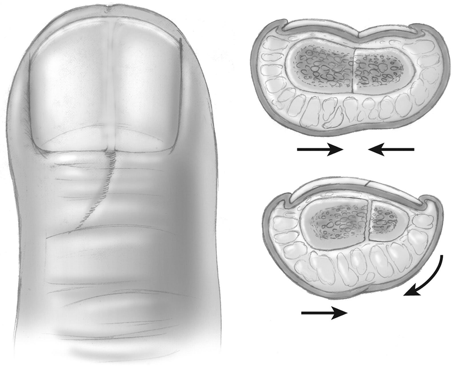 Fingernail/ظفر/指甲(Zhǐjiǎ) | Step by step into english in English