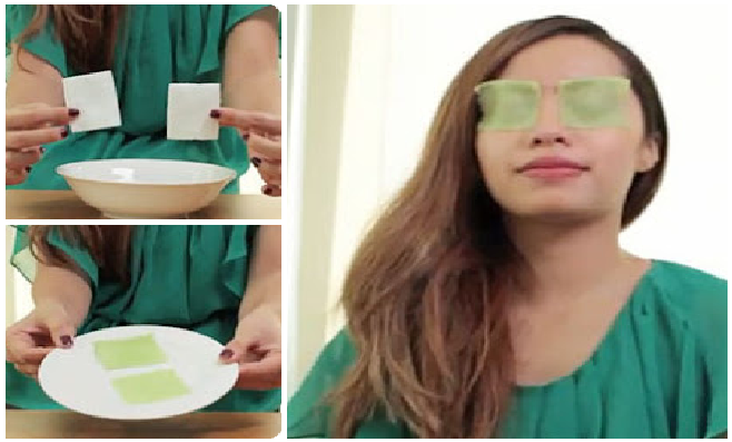 Mata Bengkak atau Ada Lebam Hitam Karena Kurang Tidur Semalaman? Yuk ...